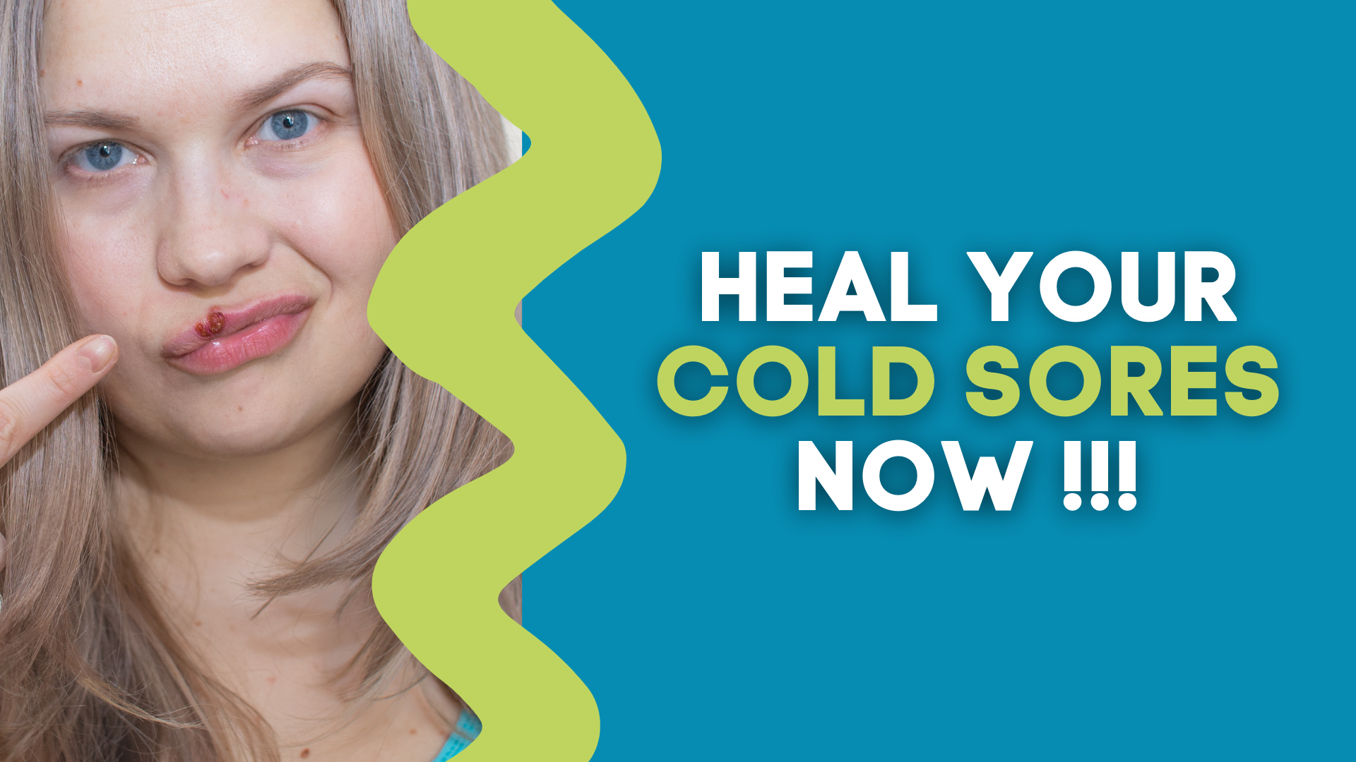 HEAL YOUR COLD SORES NOW! – The Gut Health Hub